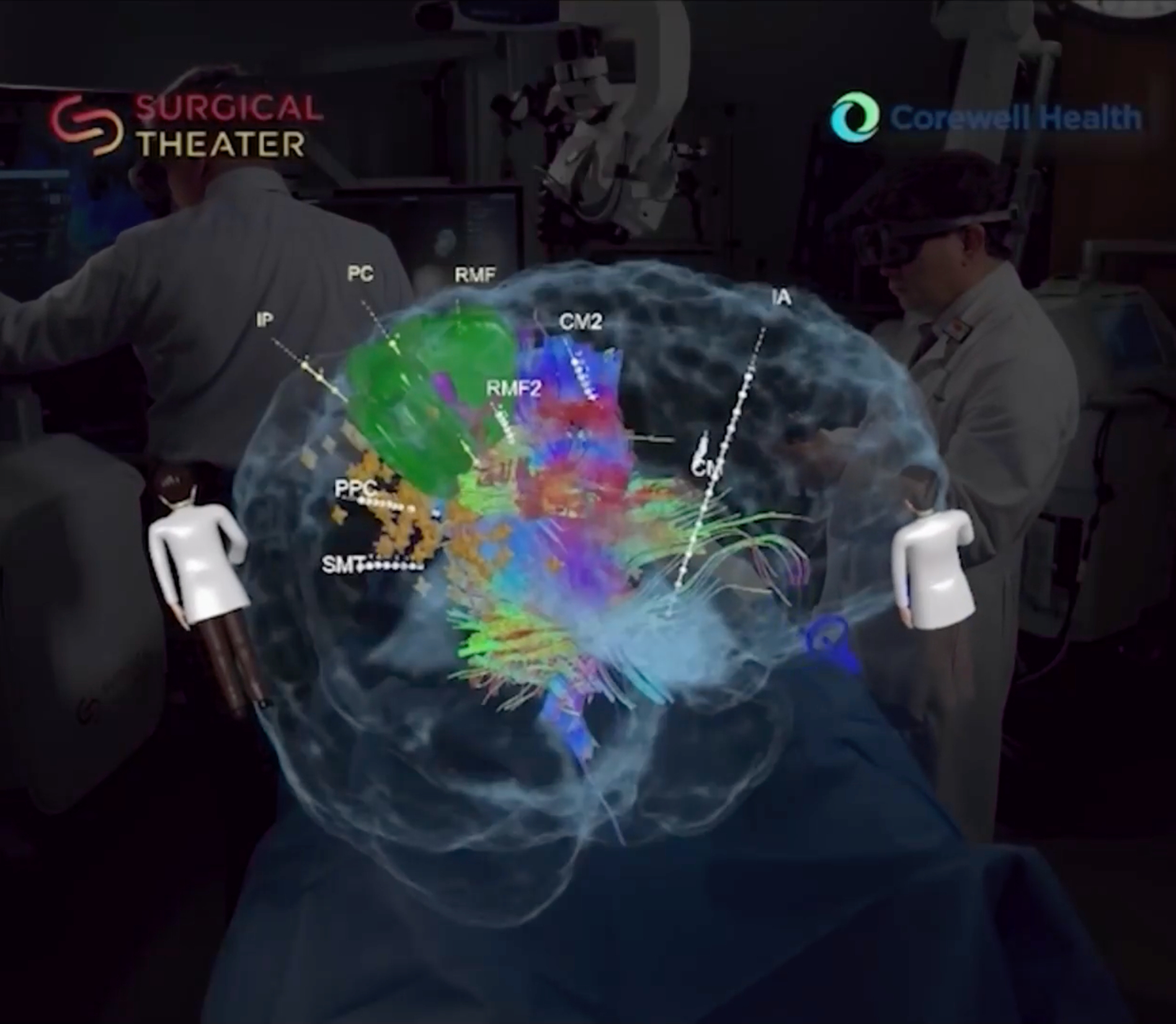 How VR is Transforming Brain Surgery at Corewell Health - Surgical Theater